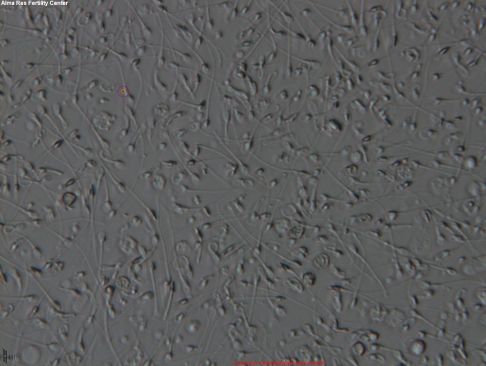 Clinica Alma Res | Studio del dna spermatico